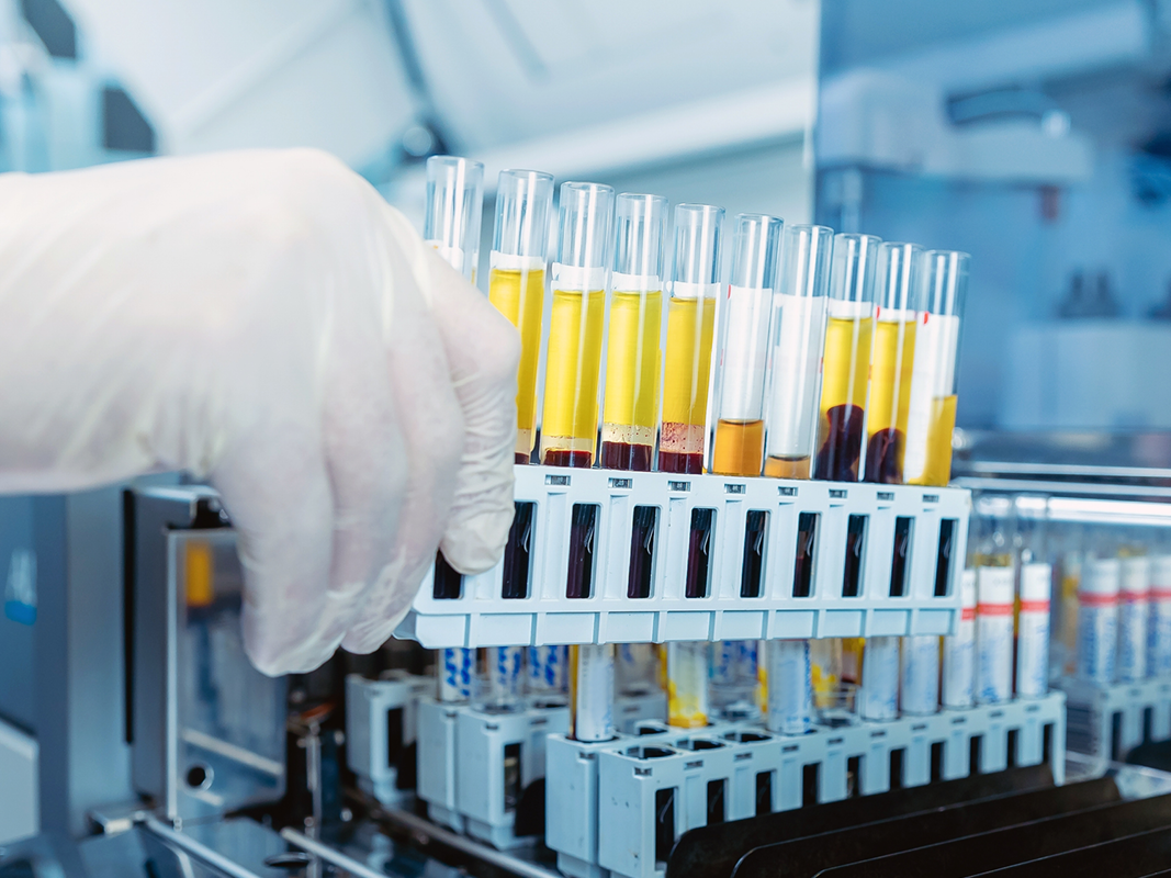 Pathology Updates: Lab Testing Upgrades at Maimonides | Maimonides Health